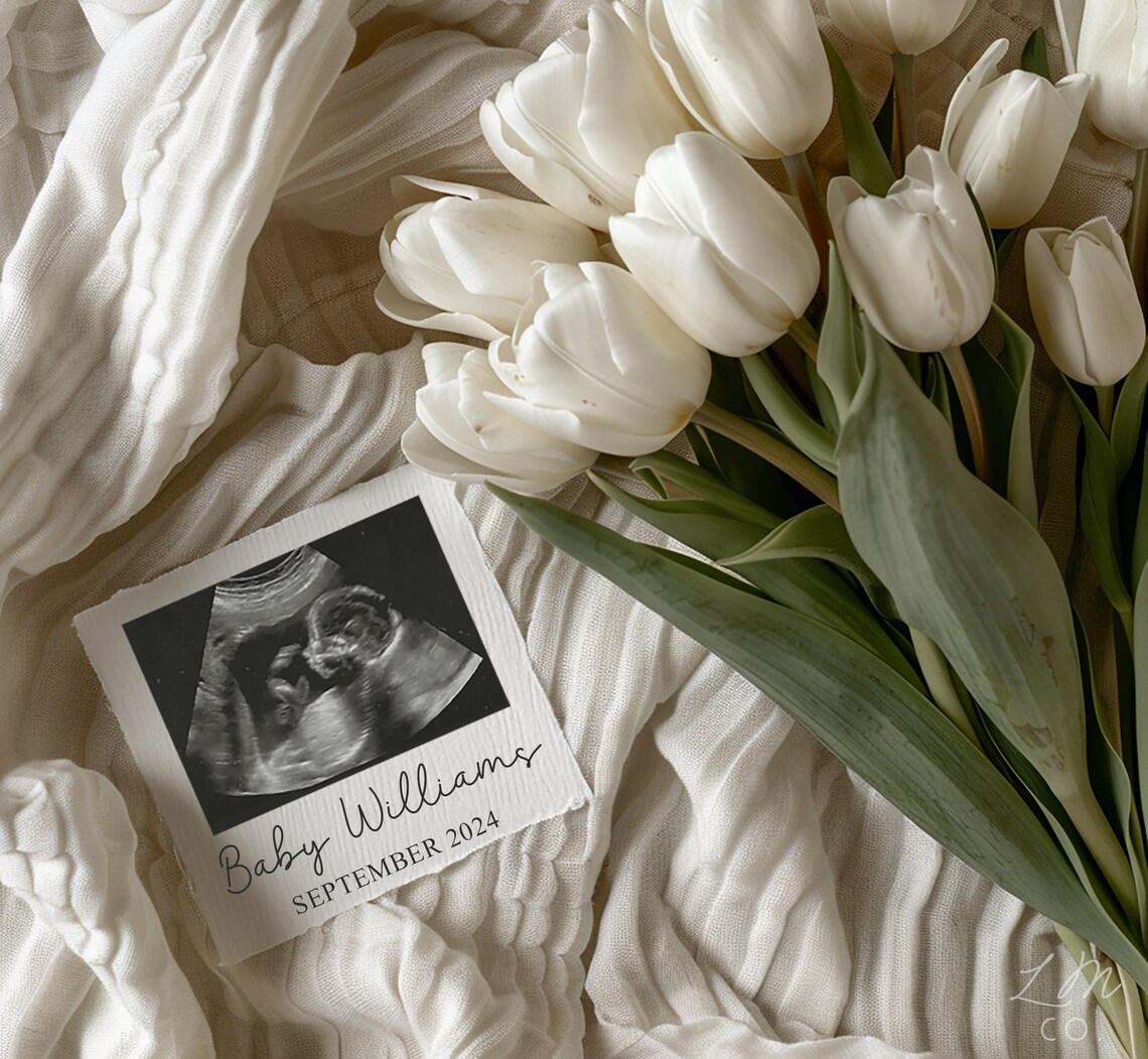 Neutral Pregnancy Announcement Digital, Spring Announcement, Editable ...