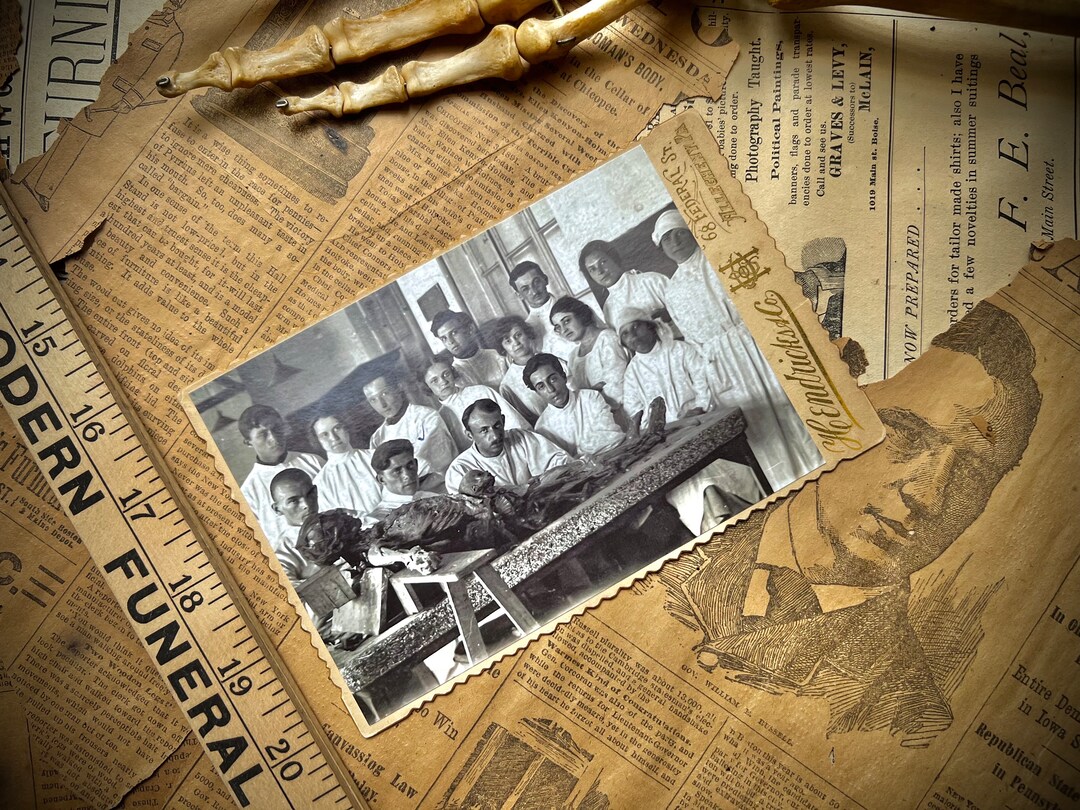 Victorian Human Dissection Cabinet Card Photograph - Etsy