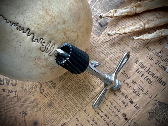 Trepanation
