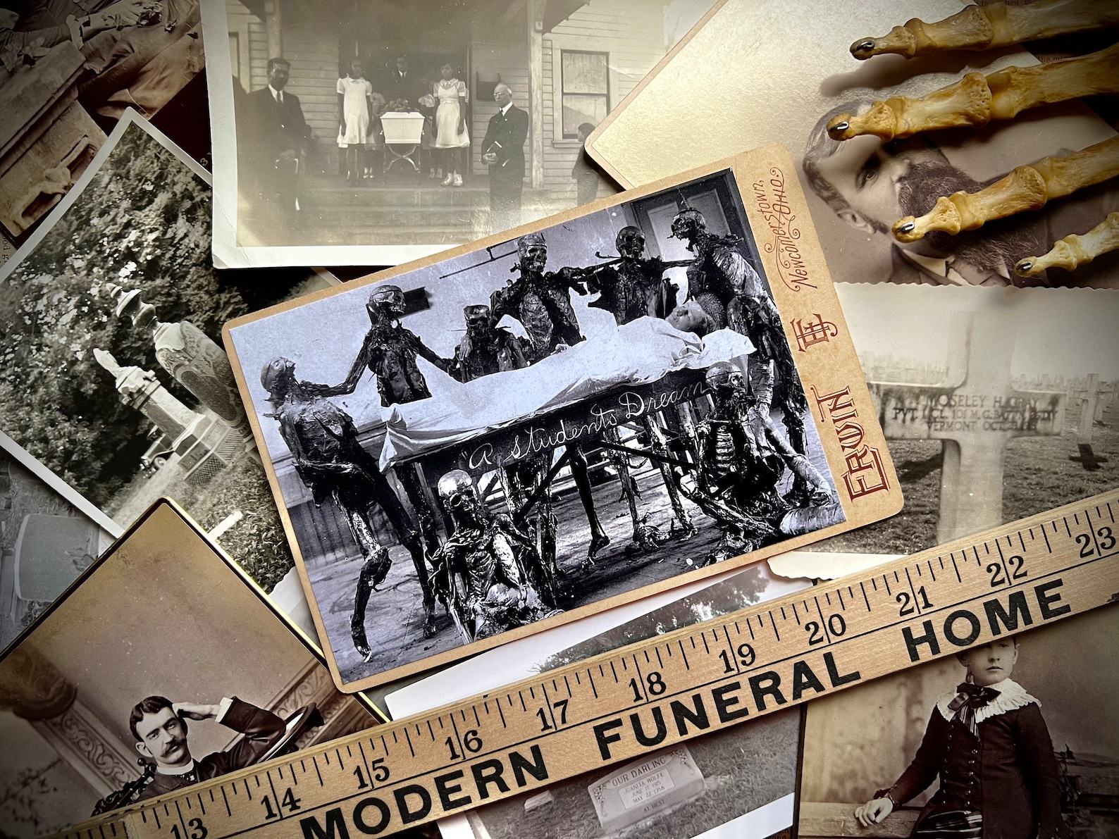 Victorian Cabinet Card Photograph Cadaver Dissection Student - Etsy