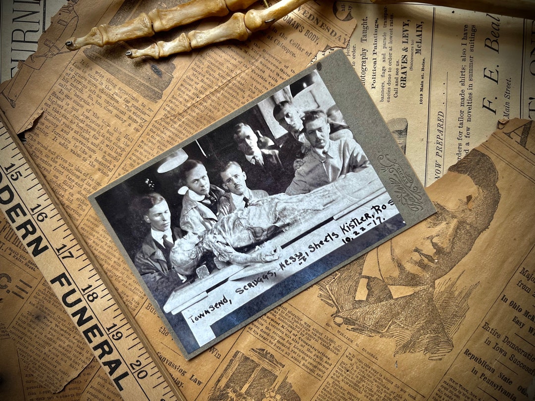 Victorian Human Dissection Cabinet Card Photograph - Etsy