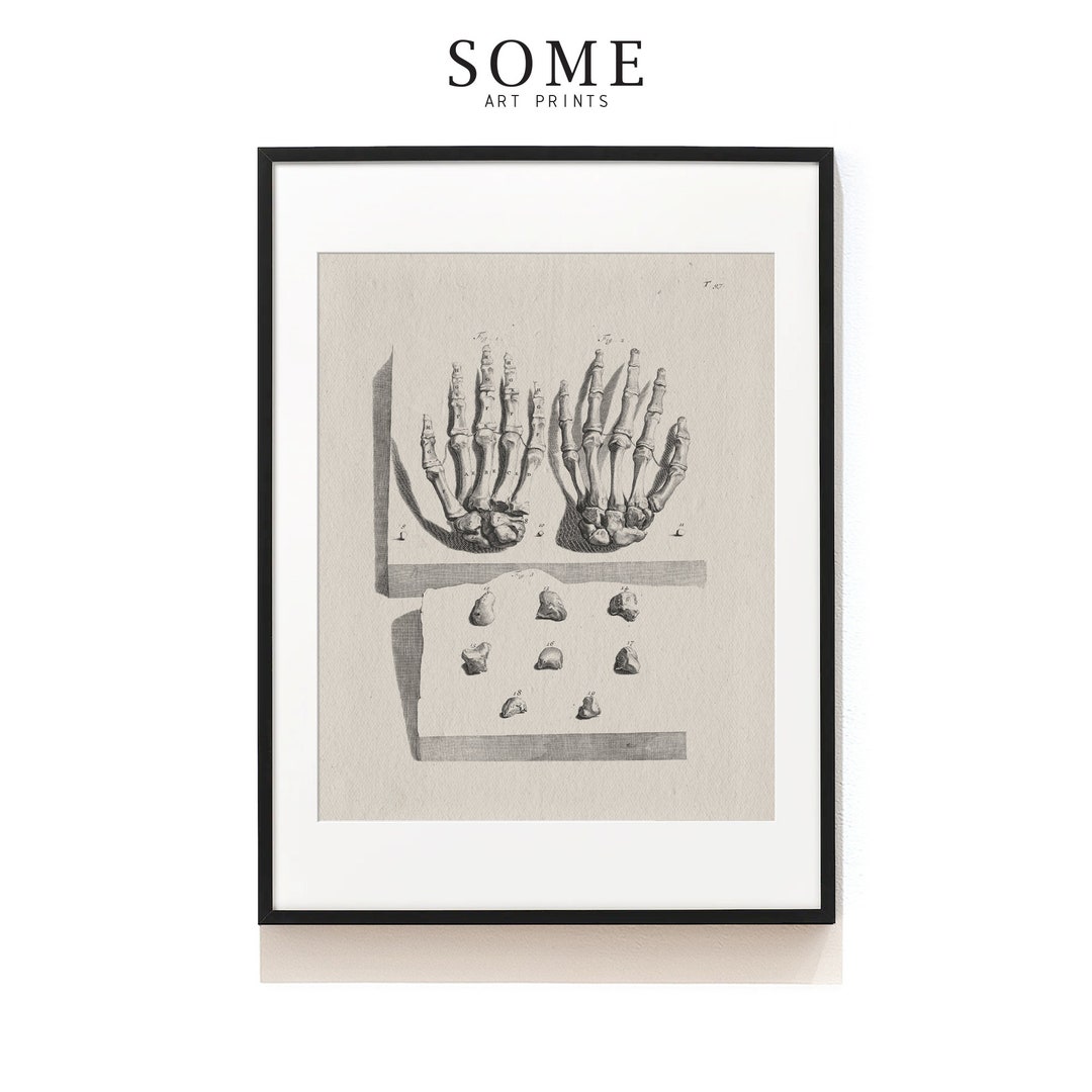 Hand Bones Anatomy Prints . Arm Skeleton Illustration . Medical Art ...