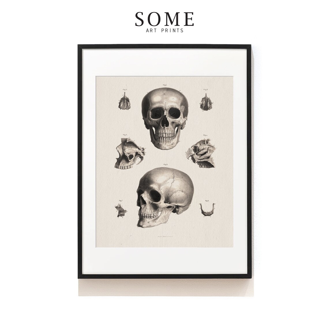 Skull Print . Human Anatomy Art . Vintage Human Skull Illustration ...