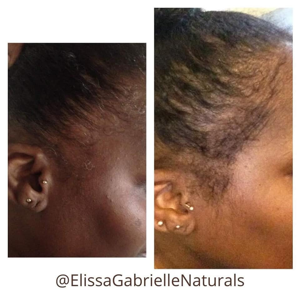 Elissa Gabrielle Naturals Revival Follicle Stimulating Cream Follicle ...