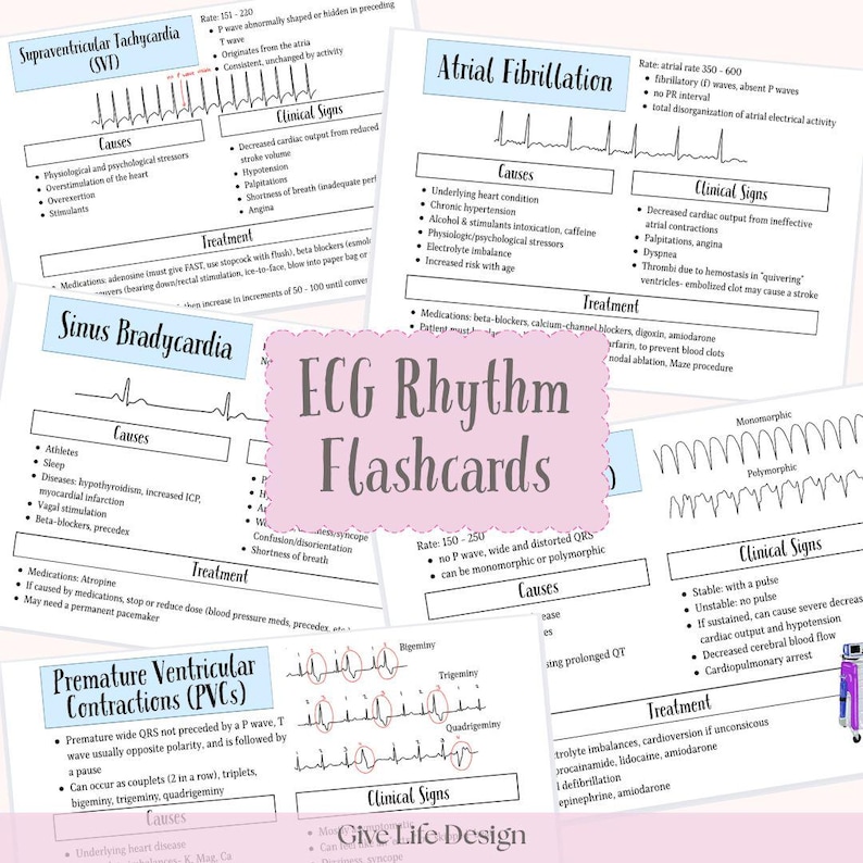 ECG Rhythm Flashcards, EKG Flashcards, Ekg Study Guide, Ecg Study Guide, Nursing School Study ...