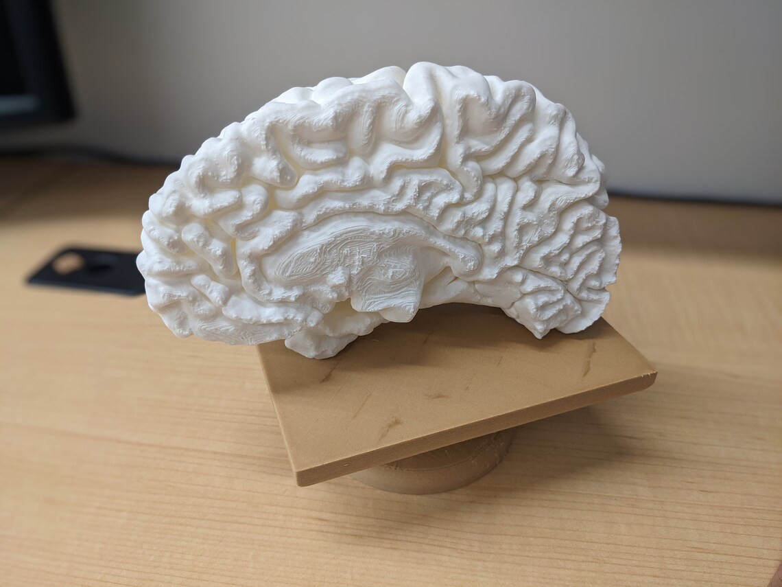 Personalized 3D Printed Brain: Unveil Your Mind's Marvels - Etsy