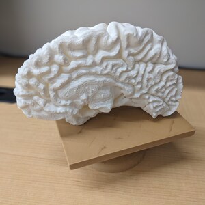 Personalized 3D Printed Brain: Unveil Your Mind's Marvels - Etsy