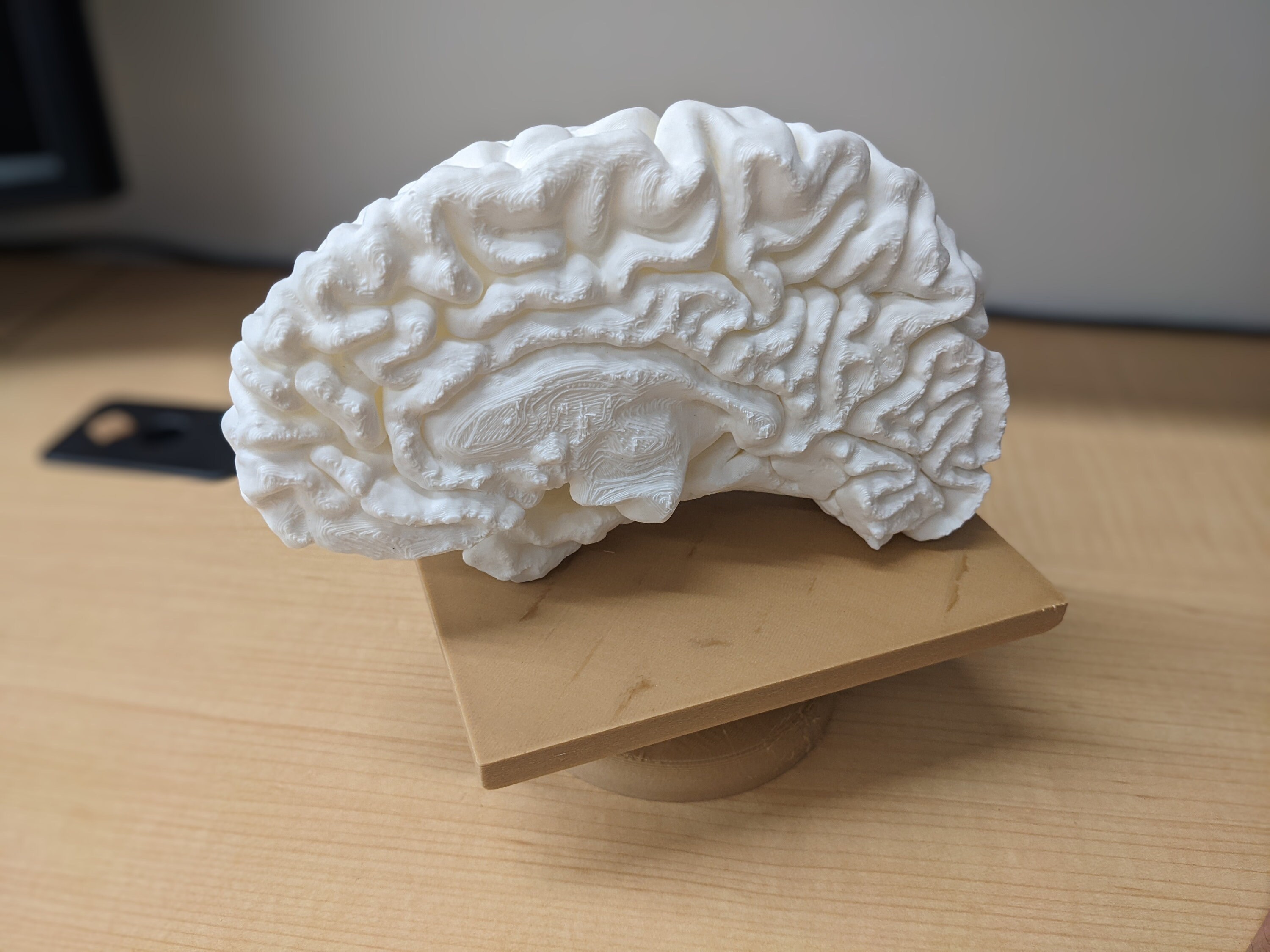 Personalized 3D Printed Brain: Unveil Your Mind's Marvels - Etsy
