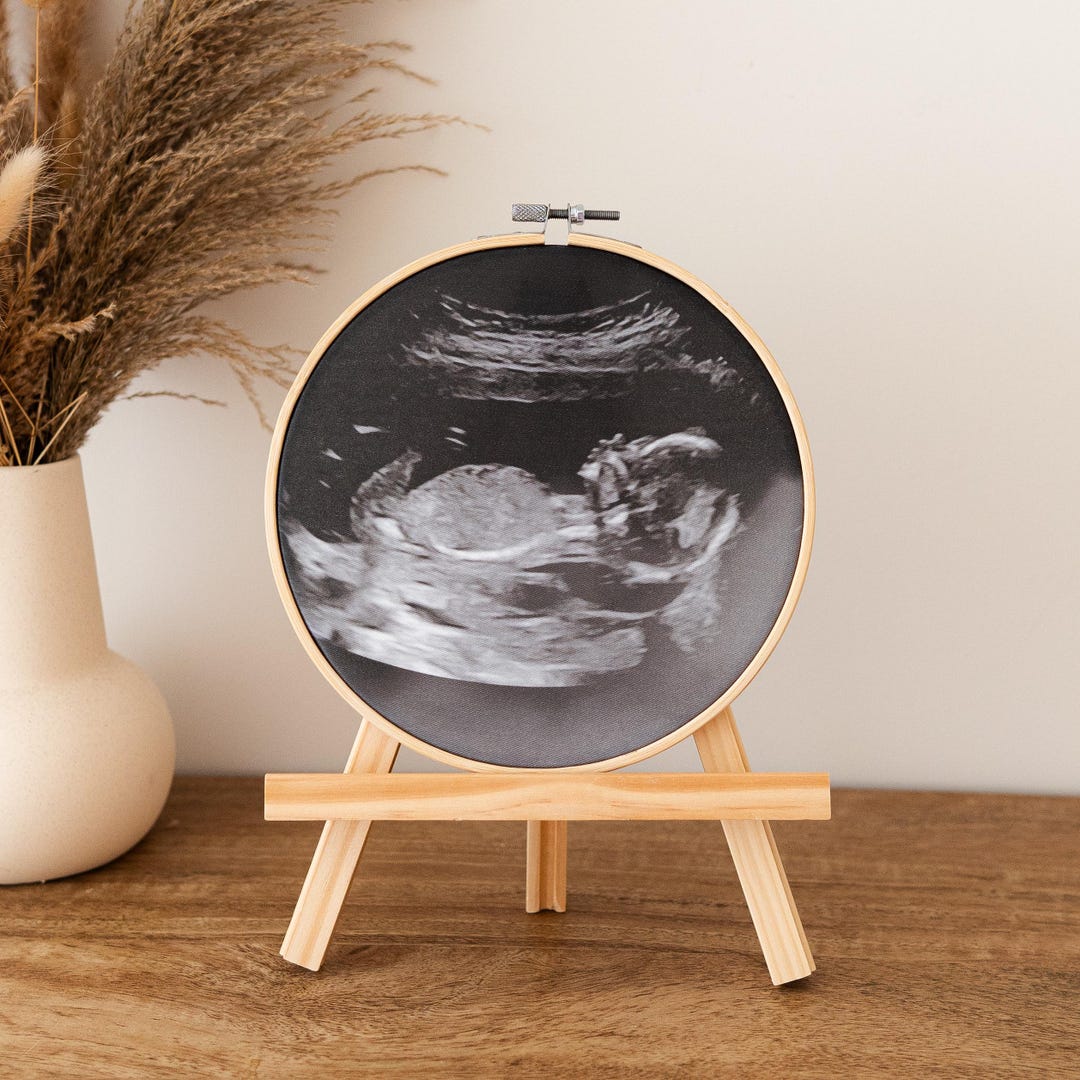 Baby Scan Photo Embroidery Hoop, Baby Scan Ornament, Baby Scan Gift - Etsy