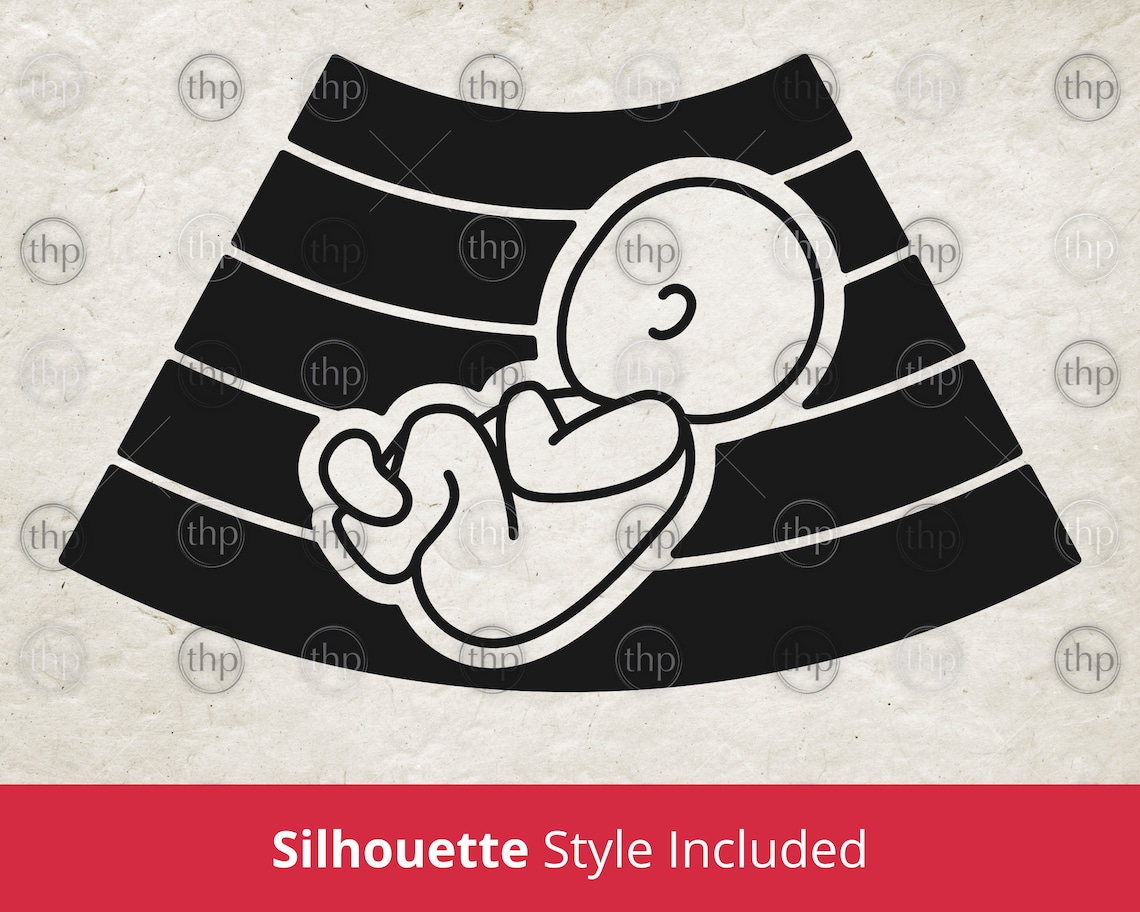 Pregnancy SVG Baby Ultrasound Svg Sonogram Svg Baby Svg - Etsy