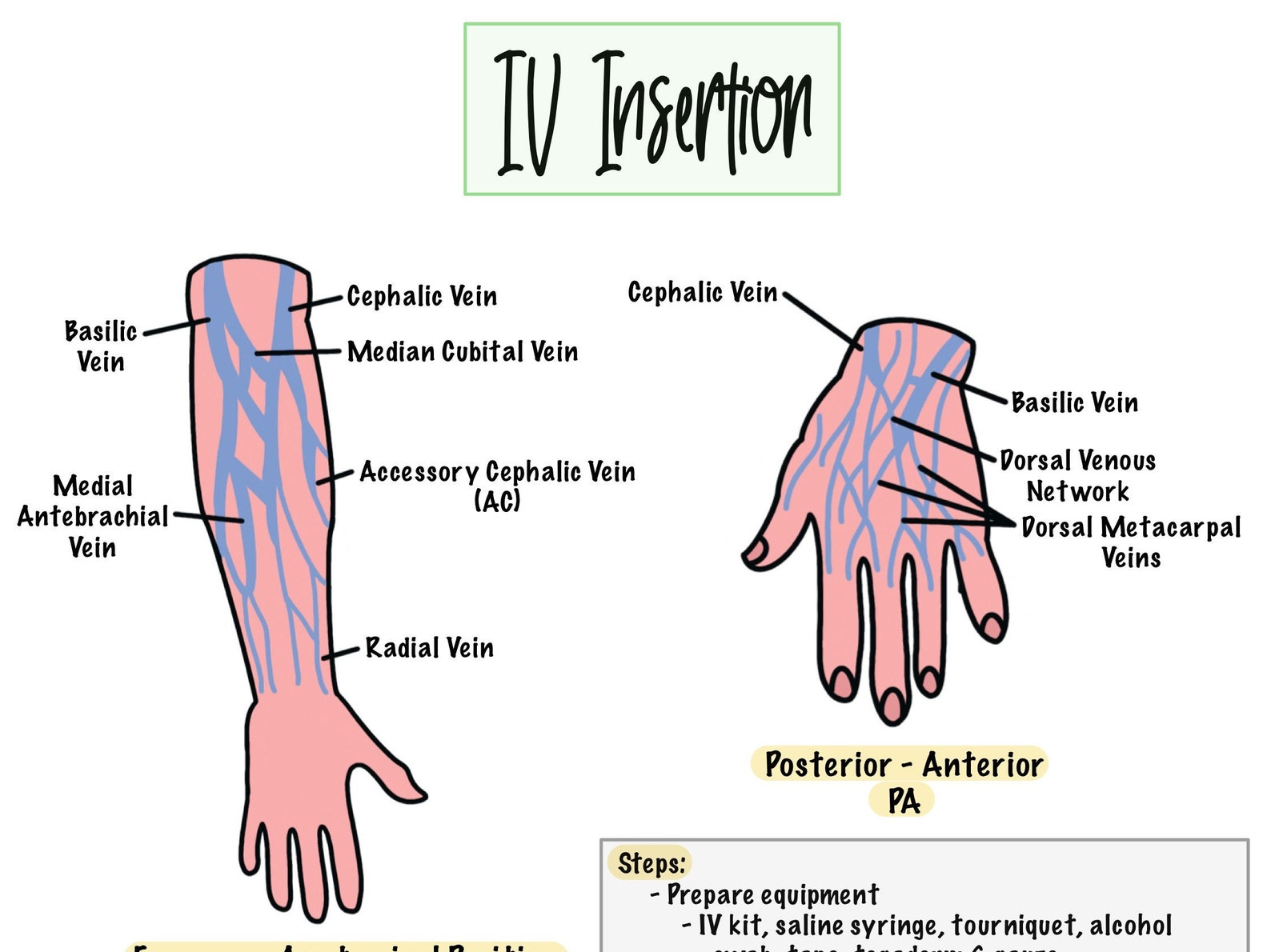IV Insertion Cheat Sheet - Etsy