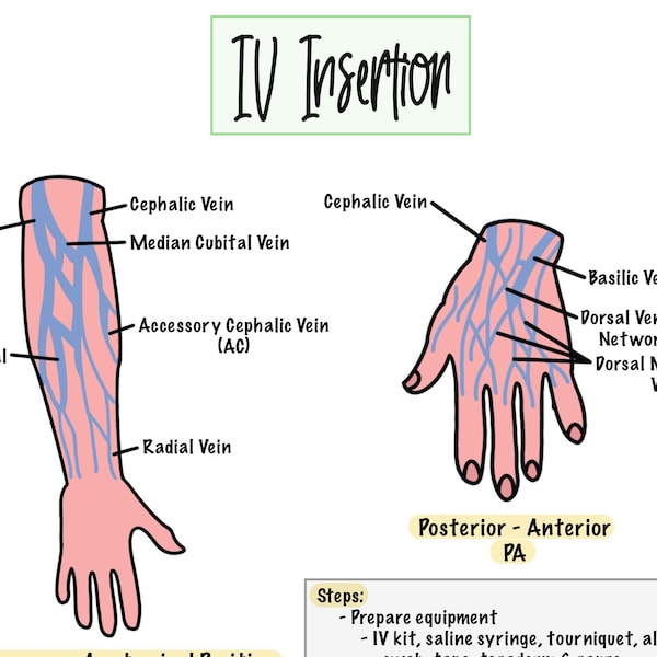 Iv Cheat Sheet - Etsy