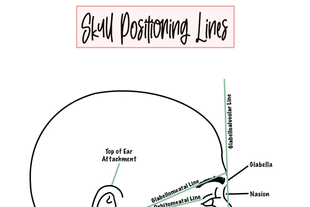 Skull Positioning Lines Cheat Sheet - Etsy
