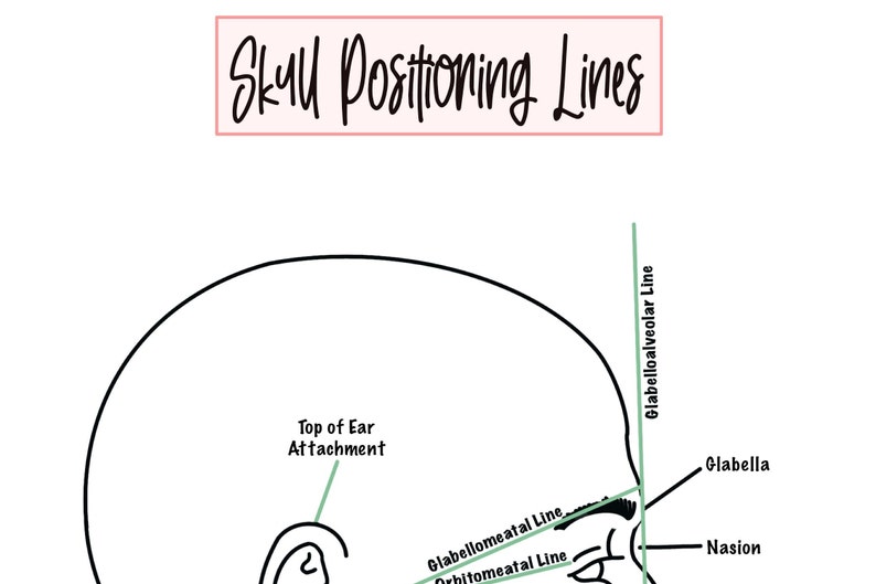 Skull Positioning Lines Cheat Sheet - Etsy
