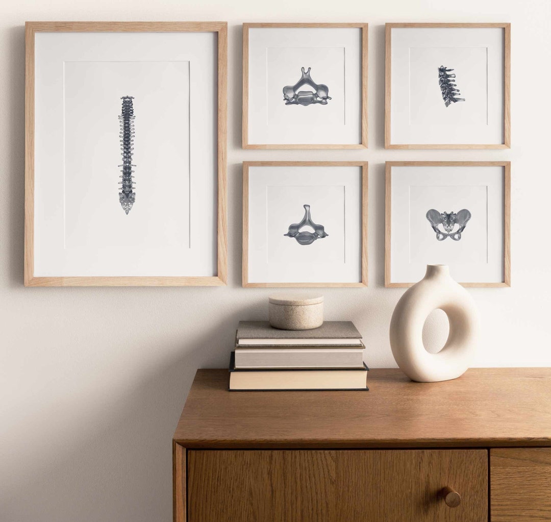 18 Xray Human Skeleton Drawings, Anatomy Printable Wall Art Set ...