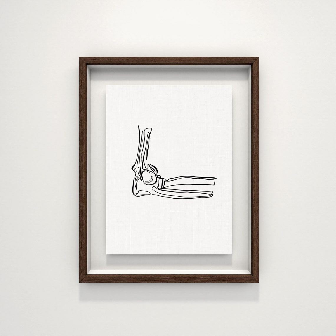Abstract Femur Bone Painting, Chiropractor Printable Wall Art, Medical ...