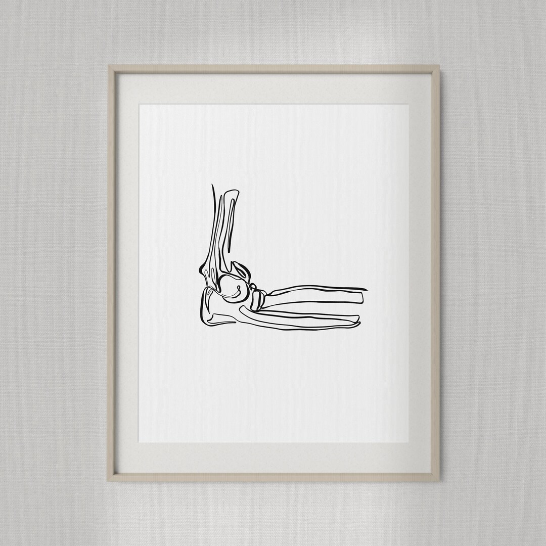 Abstract Femur Bone Painting, Chiropractor Printable Wall Art, Medical ...