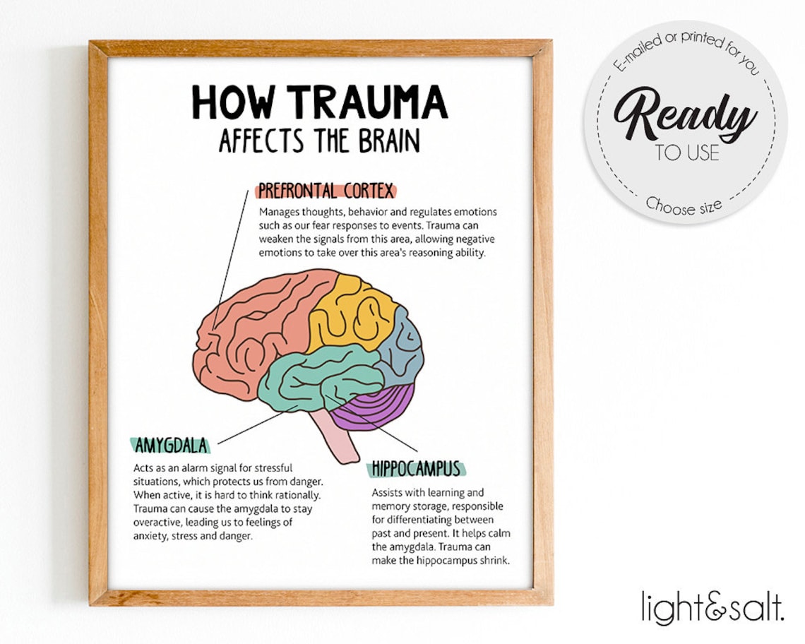 How Trauma Affects the Brain, Human Brain Poster, Brain Anatomy Poster ...