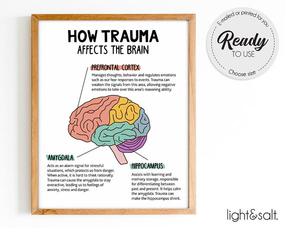 How Trauma Affects the Brain Human Brain Poster Brain - Etsy Canada