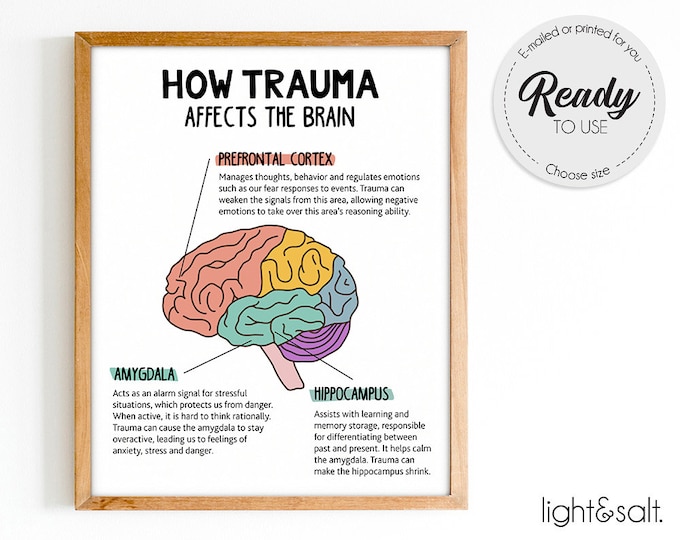 The Human Brain Poster, Brain Anatomy & Psychology, Mental Health ...