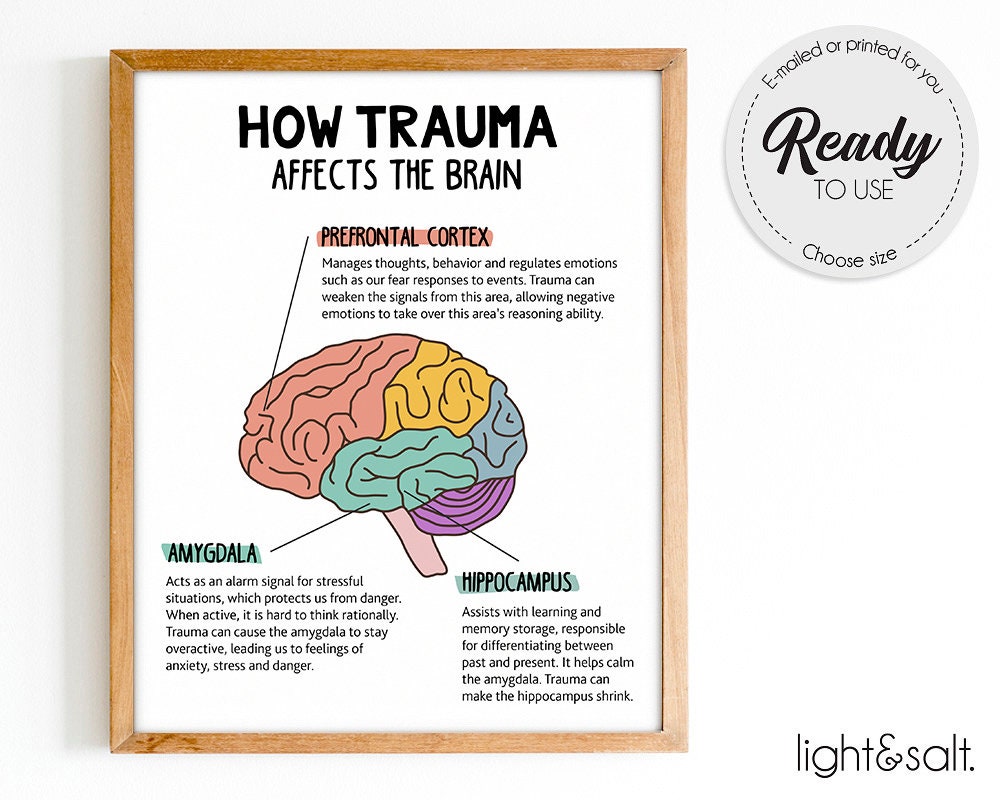 Brain Poster Ideas