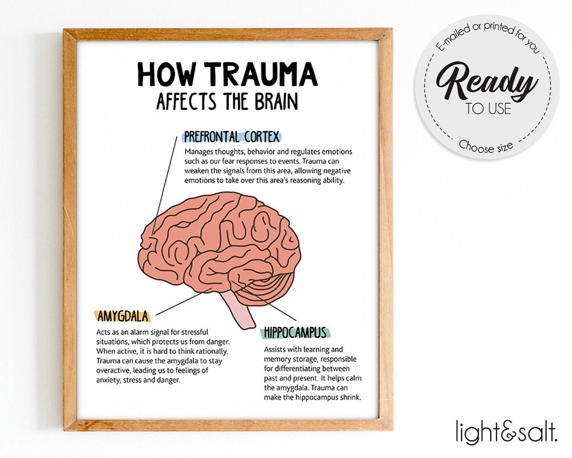 How Trauma Affects the Brain, Human Brain Poster, Brain Anatomy Poster ...