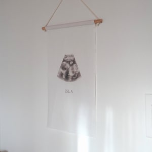 Nursery Decor, Custom Baby Ultrasound Sign, Ultrasound Nursery Wall Art ...