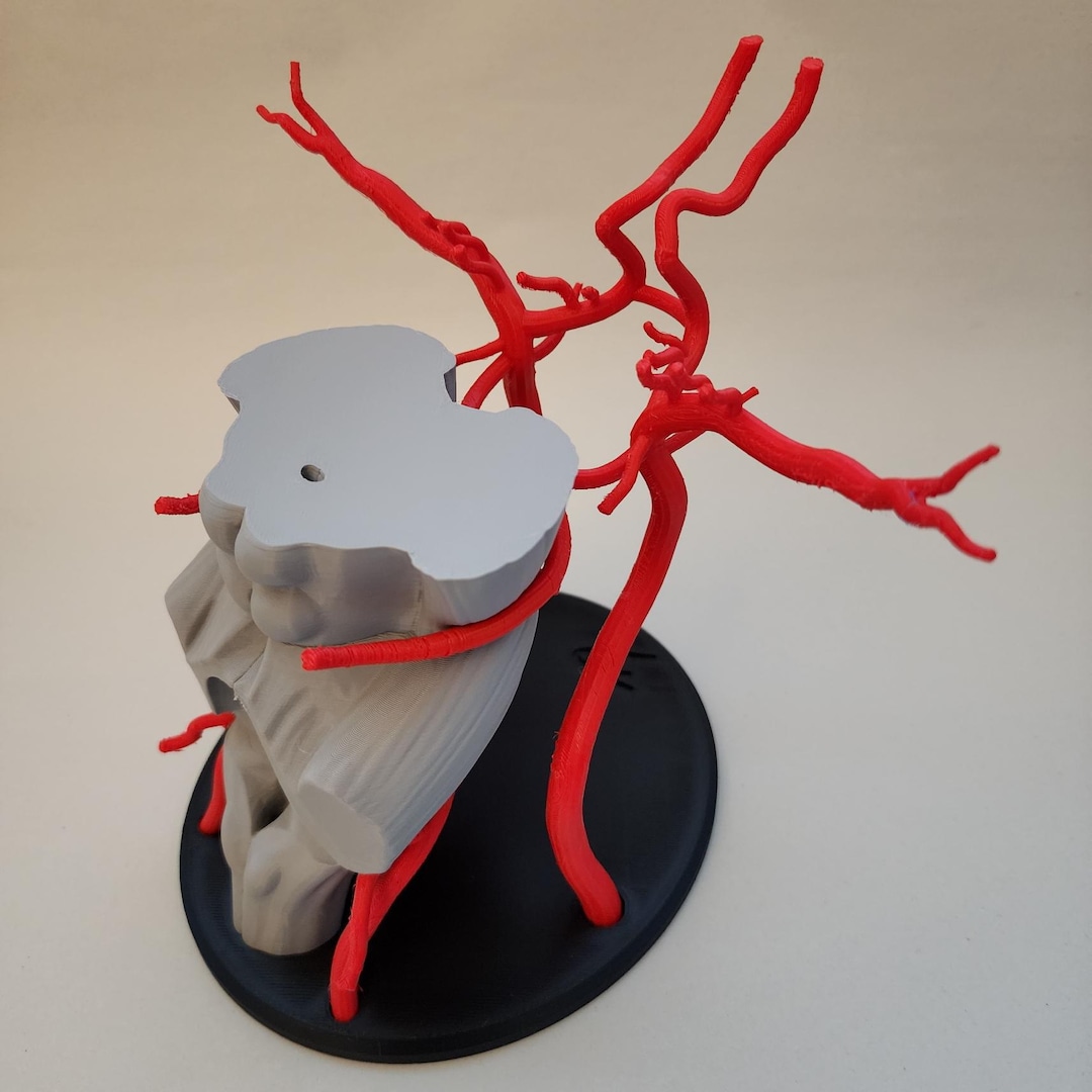 Brain Arteries/circle of Willis 3D Model - Etsy
