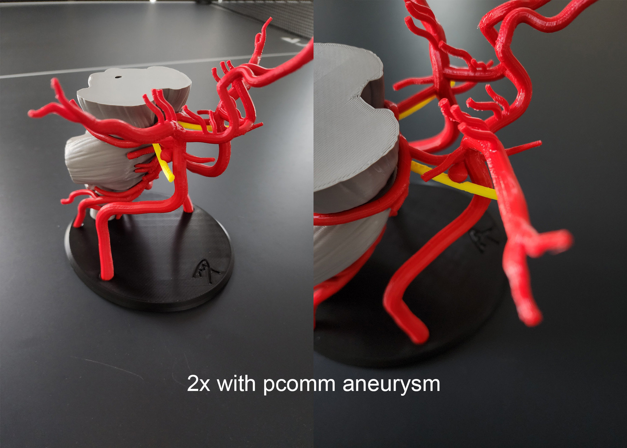 Brain Arteries/circle of Willis 3D Model - Etsy
