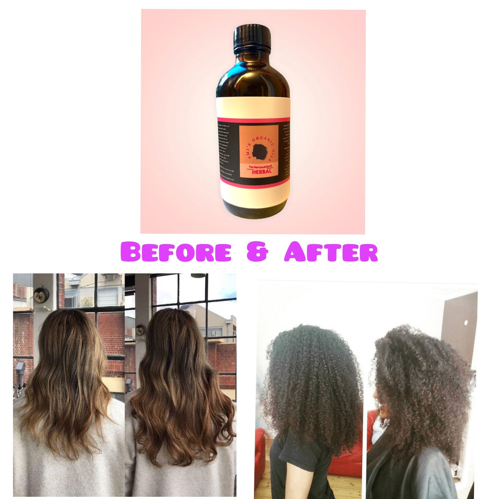 Hair Growth Oil | Alopecia Oil |hair Scalp Treatment | Thick Hair ...