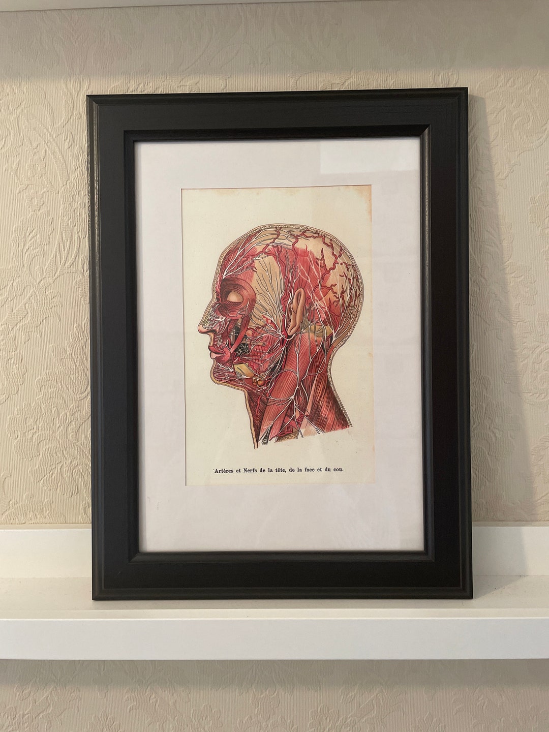 Original Vintage Anatomical Drawing Print of Head With Arteries, Nerves ...