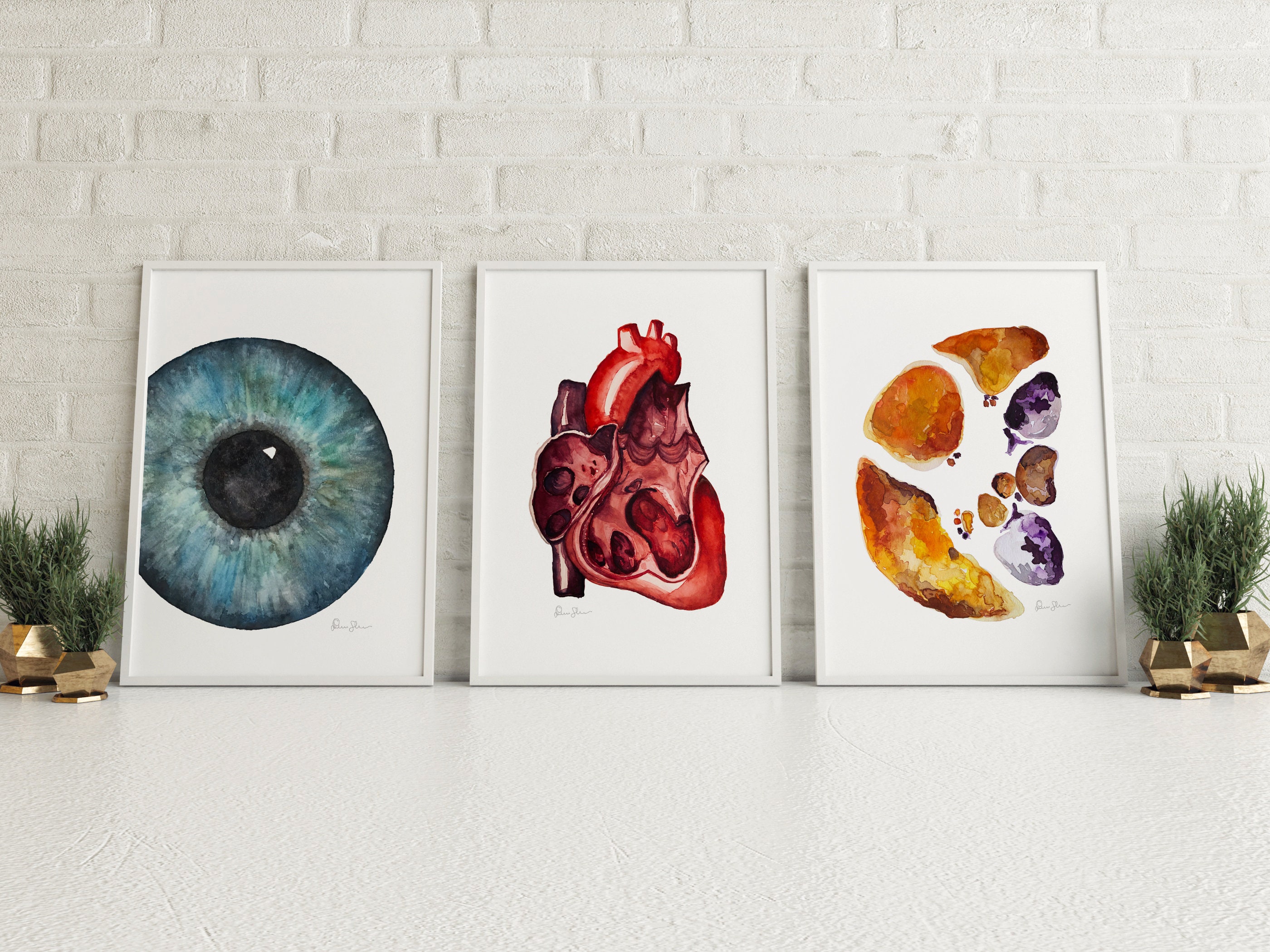 Blue Iris Eye Watercolor Print - Ophthalmology Art - Optometry Art ...