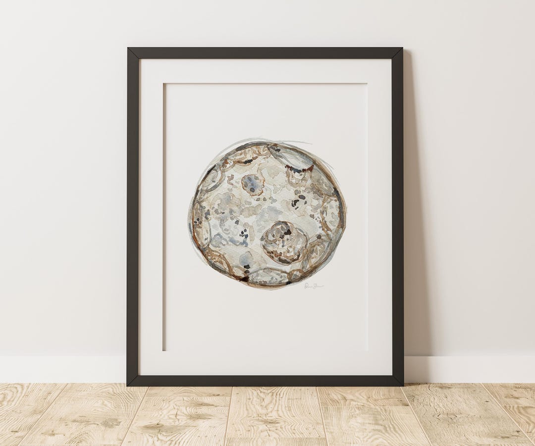 Embryo Art - IVF Art - OBGYN Art - Fertility Art - MFM Art - Medical ...