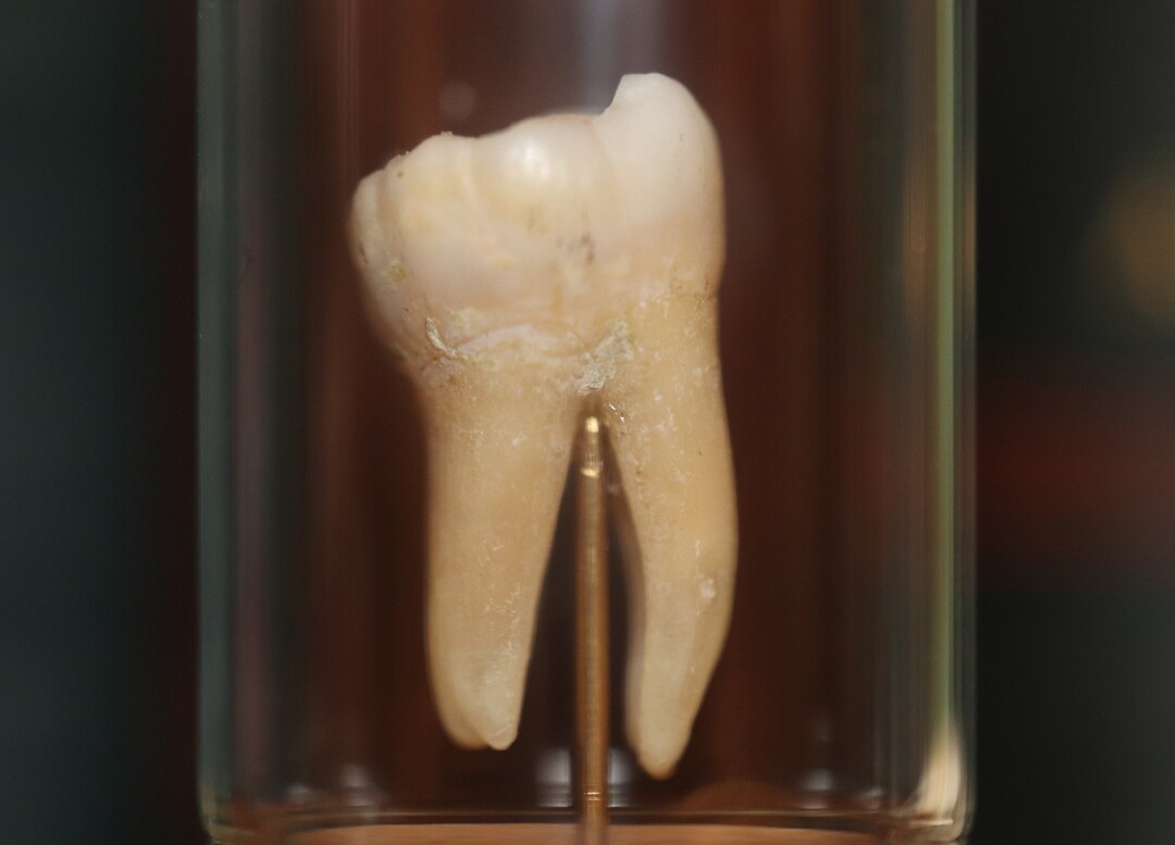 Real Human Tooth Display in Glass Cloche | Unique Curio Cabinet ...