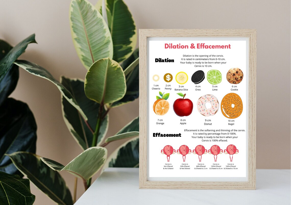 Cervical Dilation Chart Handout, Cervical Dilation Tool, Cervical ...