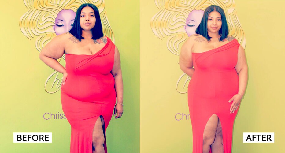 Body Shaper Full Compression Faja Post Surgery Post Op Post - Etsy