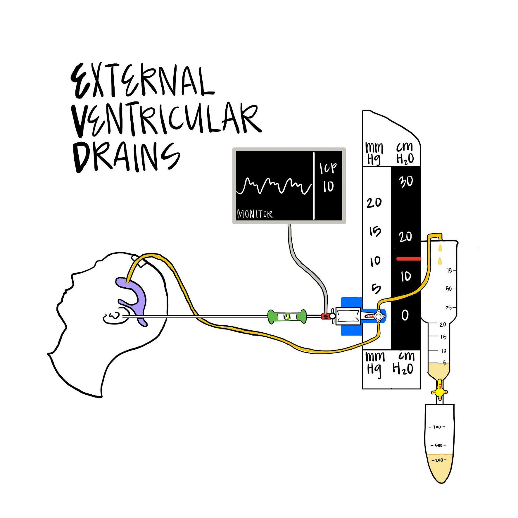 EVD Monitor Tips & How-to | Etsy