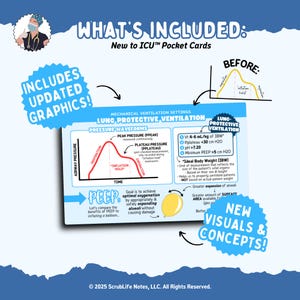 Mechanical Ventilation Pocket Card | New to ICU® Quick Reference ...
