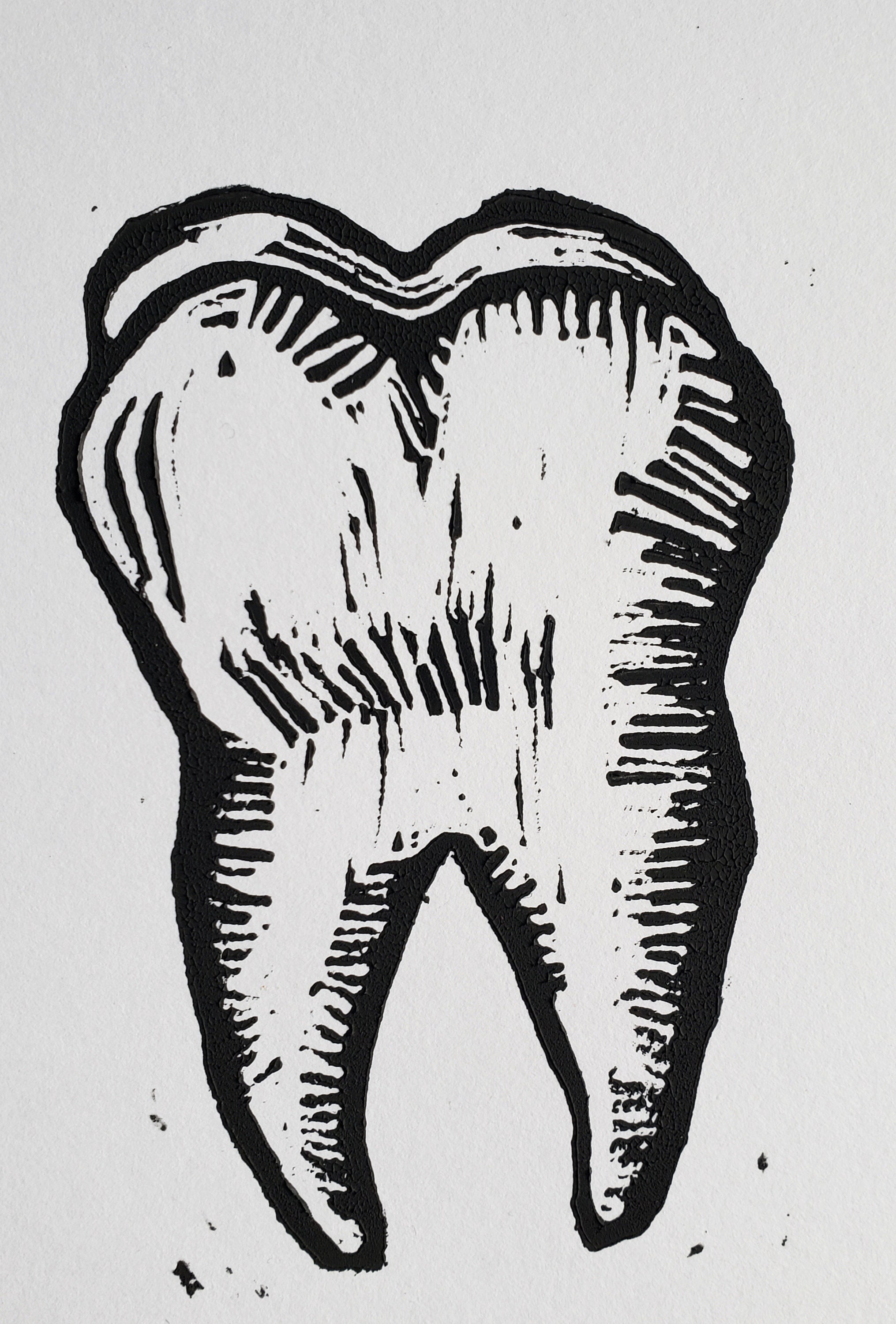 Tooth Lino Print Spooky Wall Art - Etsy