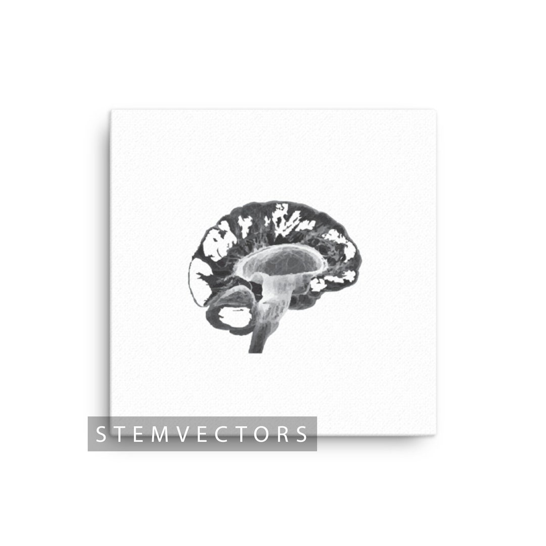 Brain Cross-section digital Download Black and White Vector - Etsy