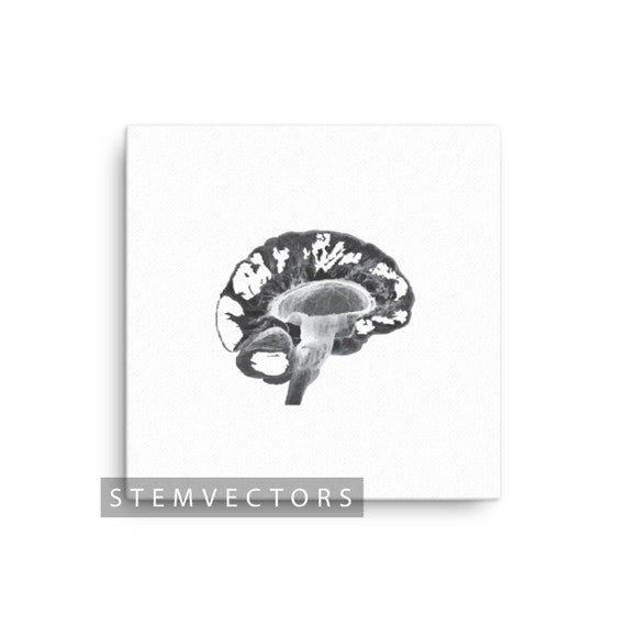 Brain Cross-section digital Download Black and White Vector - Etsy