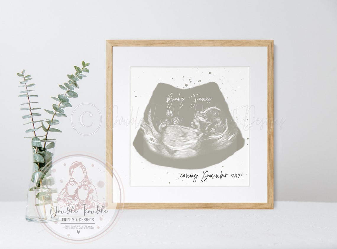 BABY SCAN GIFT Ultra Sound Gift for Baby Shower Gift for | Etsy