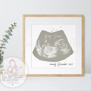 BABY SCAN GIFT Ultra Sound Gift for Baby Shower Gift for | Etsy