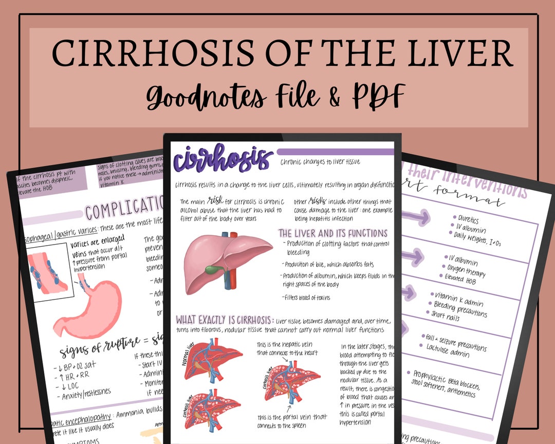 Cirrhosis Nursing Notes // Digital Download // Goodnotes File & PDF - Etsy
