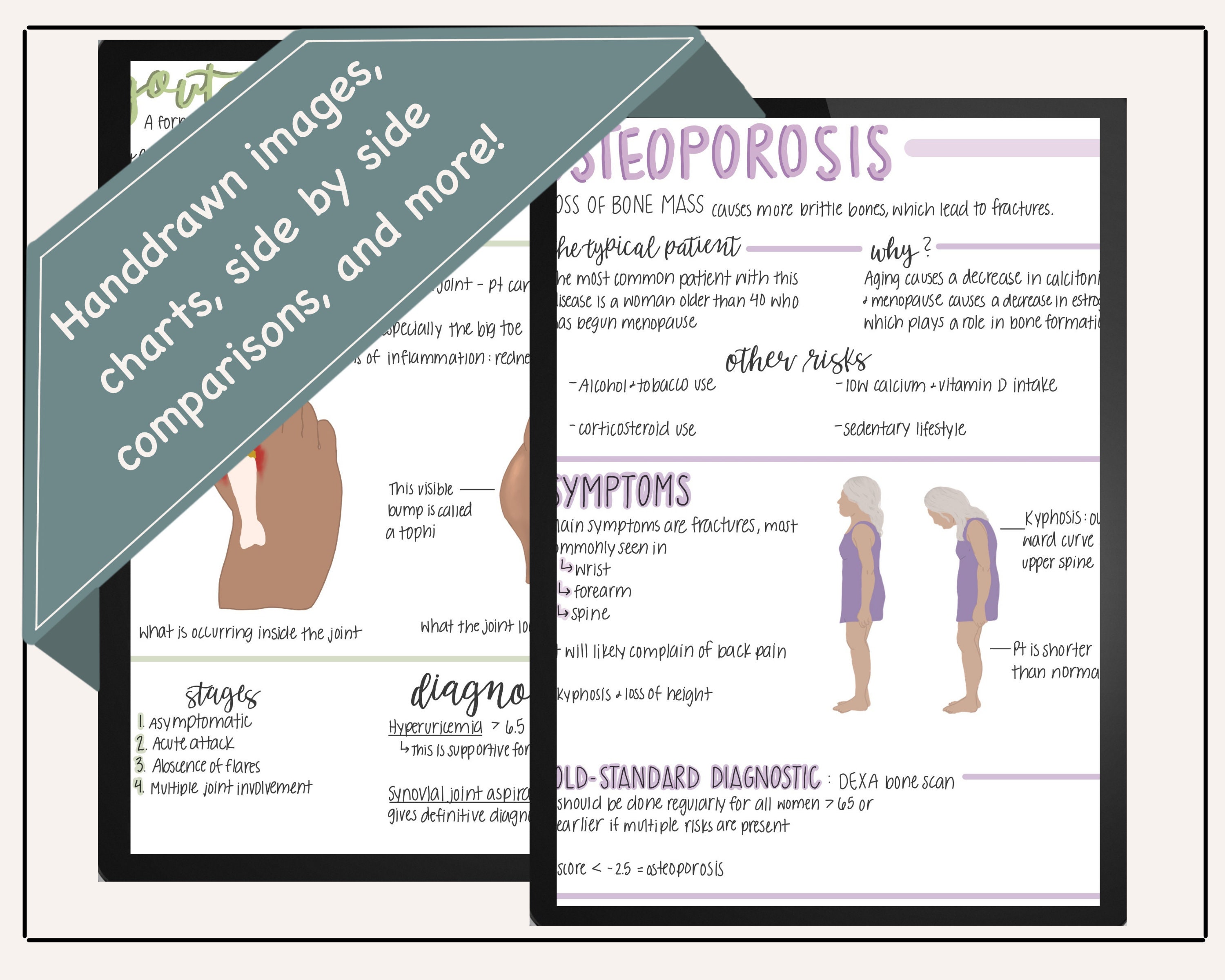 Complete Med-surge Nursing Bundle // Digital Download // Goodnotes ...