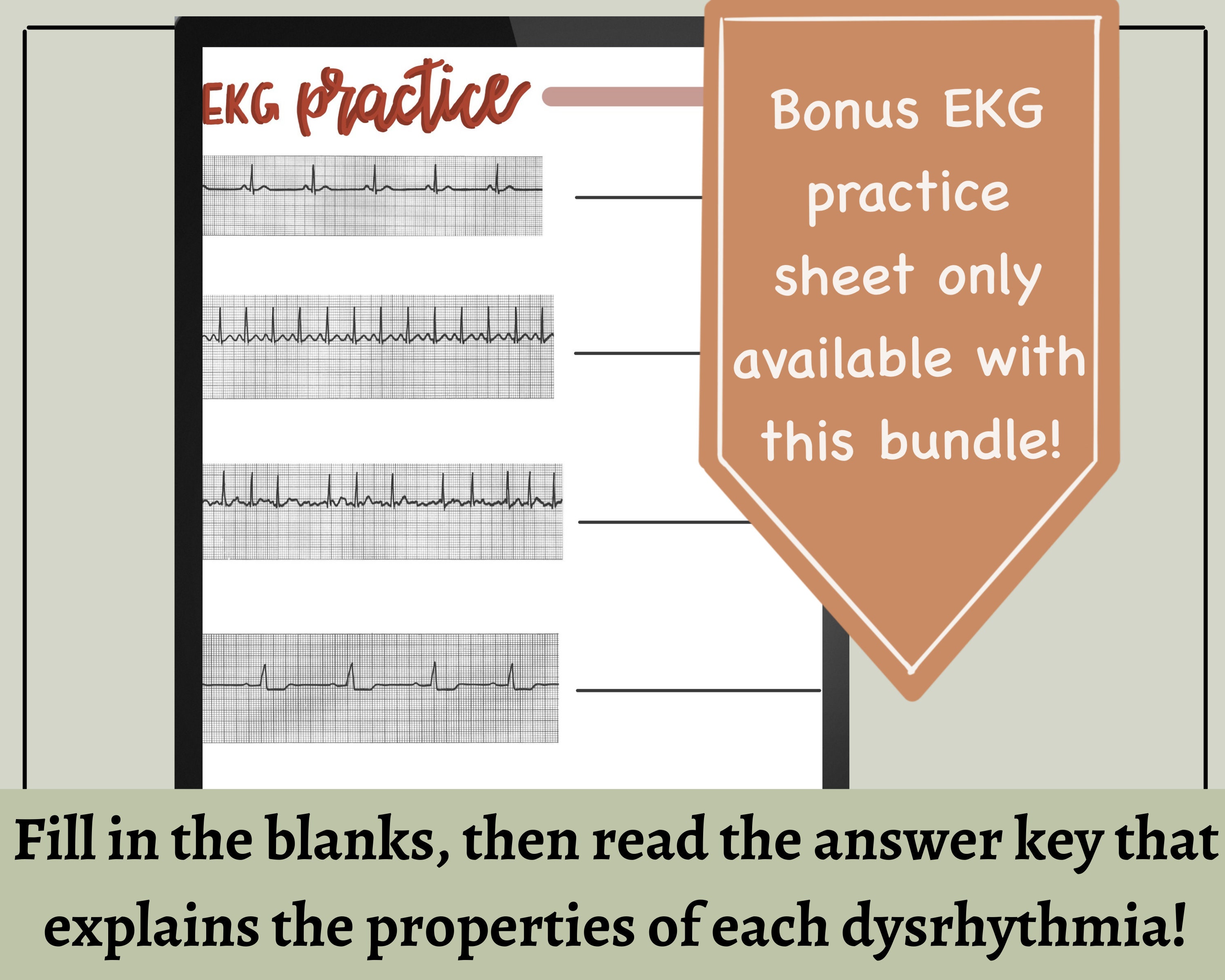 Cardiac Disorders Nursing Note Bundle // Digital Download // Goodnotes ...