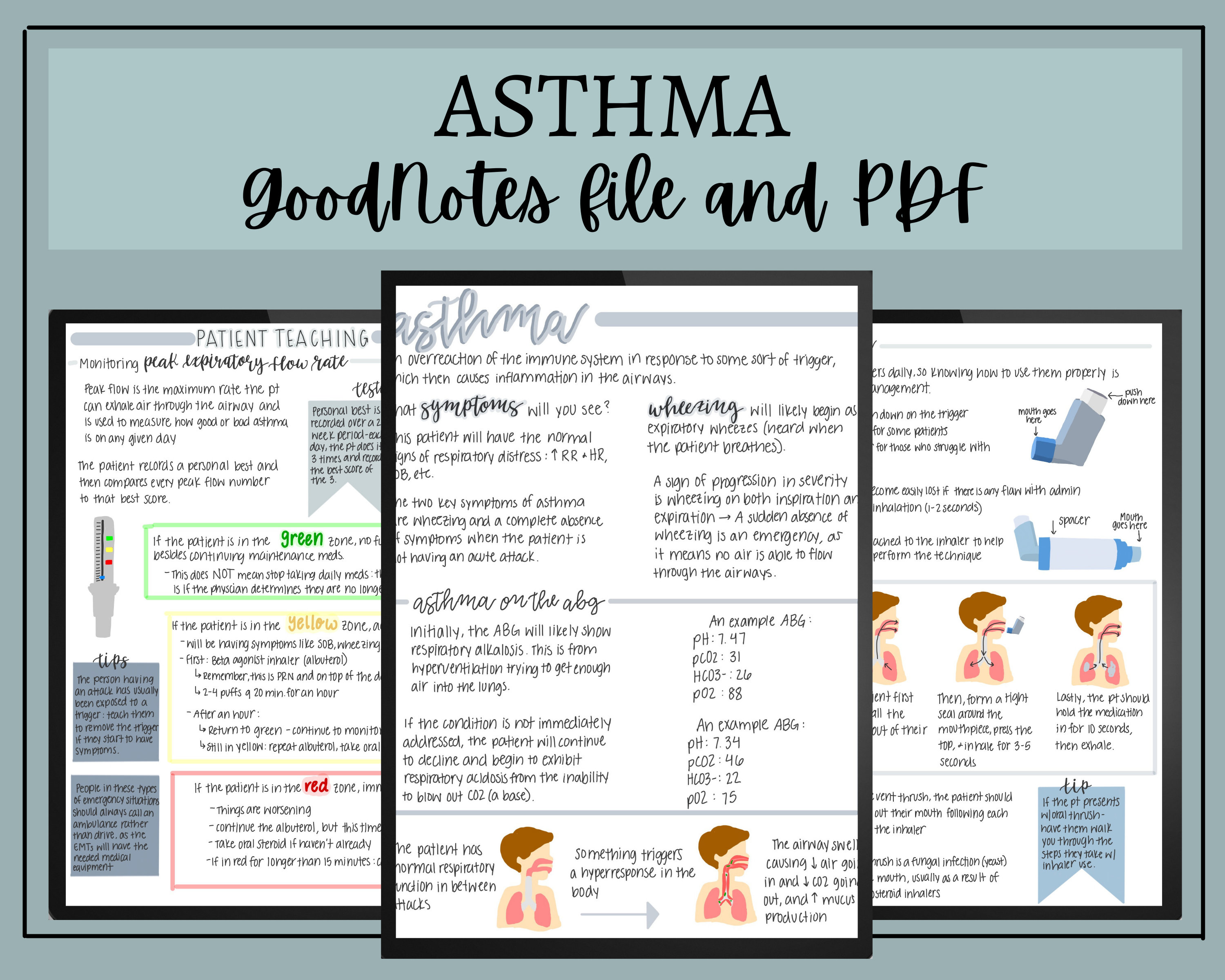 Asthma Nursing Notes // Digital Download // Goodnotes File & PDF - Etsy UK