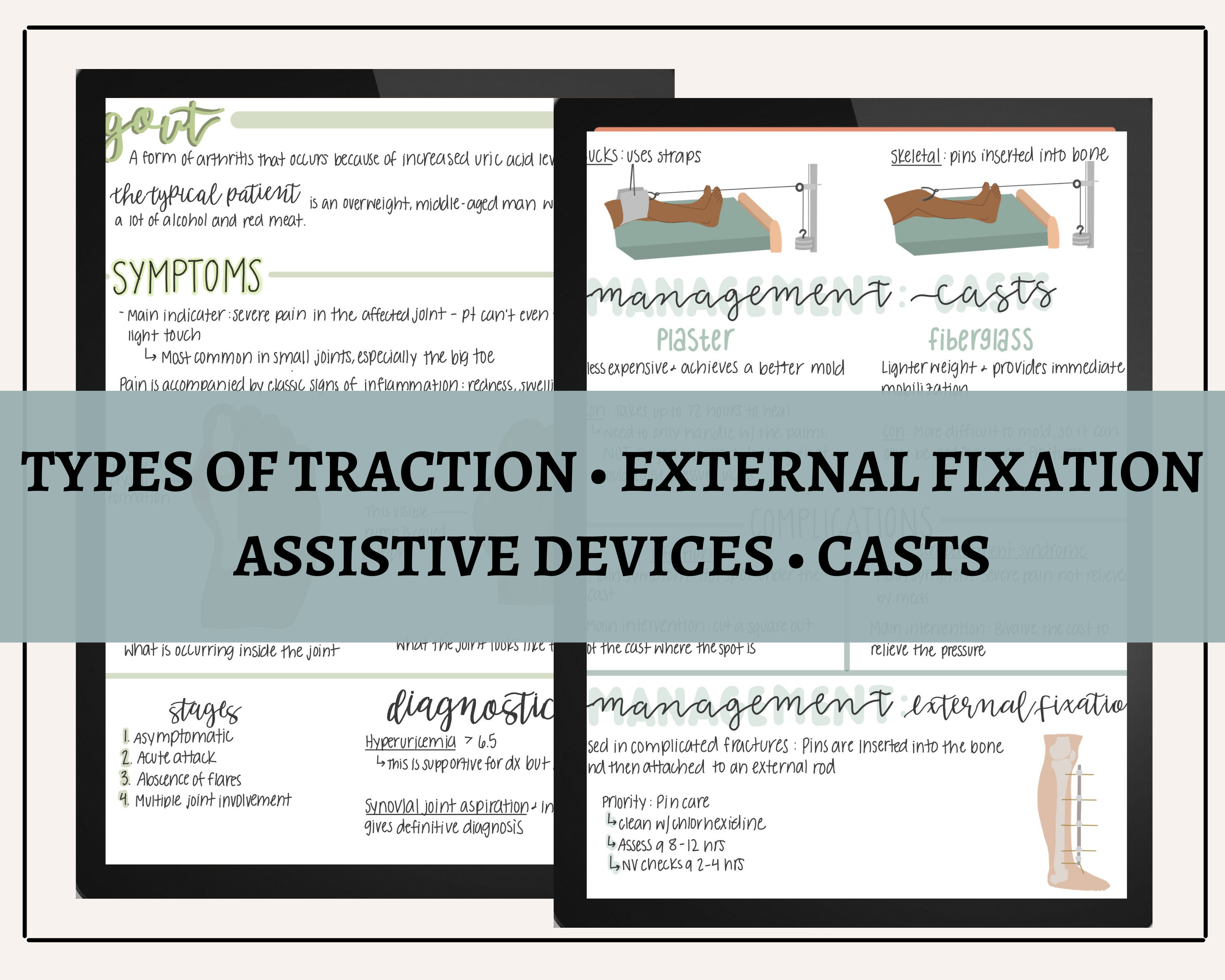 Musculoskeletal Bundle Nursing Notes // Digital Download // Goodnotes ...