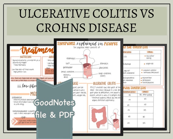 Ulcerative Colitis vs Crohns Disease Nursing Notes // Digital | Etsy
