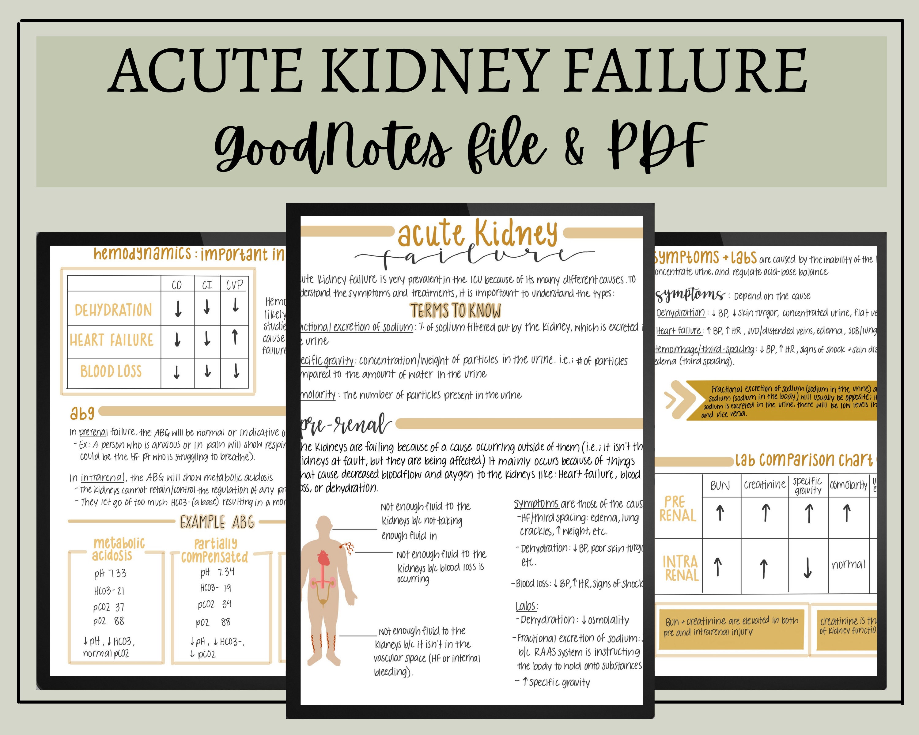 Acute Kidney Failure Nursing Notes // Digital Download // Goodnotes ...